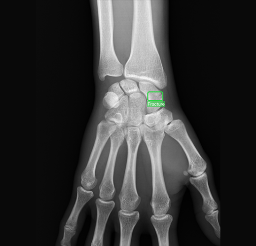 TechCare Alert 🚑 - Milvue